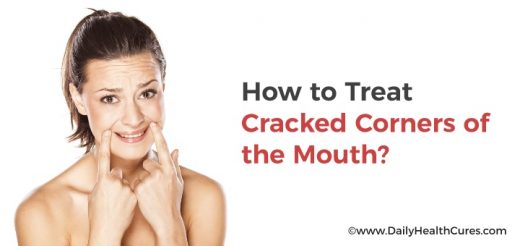 Cracked Corners of Mouth (Angular Cheilitis): 6 Causes & Treatments