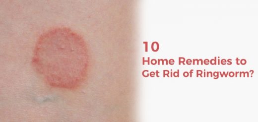 How to Get Rid of Ringworm Permanently At Home?