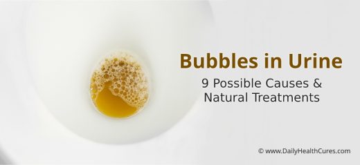 Bubbles in Urine: 9 Possible Causes and Natural Treatments