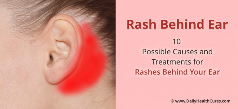 Rash behind Ear: 10 Possible Causes and Natural Treatments