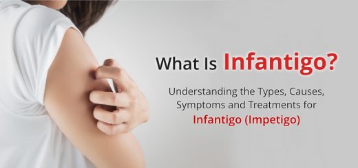 Infantigo: Types, Causes, Contagious, Symptoms, and Home Remedies