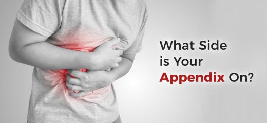 What Side is Your Appendix On? Appendicitis Symptoms, Treatments