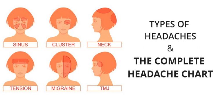 Headache Chart: Types of Headaches, Causes, Symptoms, Treatments ...