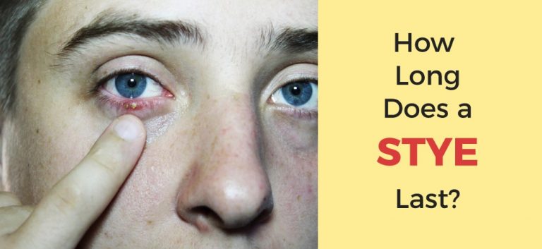How Long does a Stye Last? How to Make a Stye Go Away Fast?