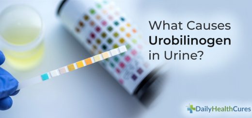 Urobilinogen: 10 Possible Causes, Diagnosis, Treatments and Prevention