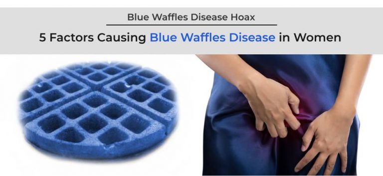 5 Factors Causing Blue Waffles Disease in Women