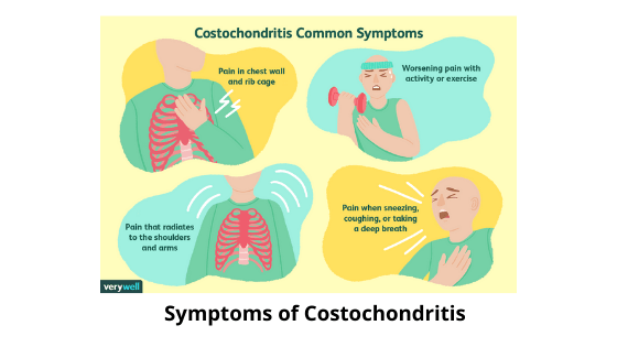 Costochondritis: List of Causes, Symptoms and Treatment