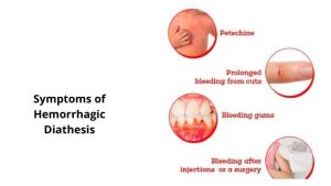 Hemorrhagic Diathesis: Causes, Symptoms and Treatment