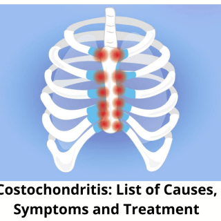 Costochondritis Treatment Archives | Daily Health Cures
